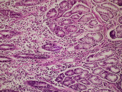 Postbiotics - Our Guide To Pre, Pro & Postbiotics - goop