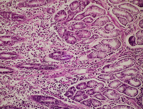 Postbiotics - Our Guide To Pre, Pro & Postbiotics - goop