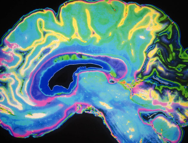 Are There Side Effects from MRI Contrast Dyes? | goop