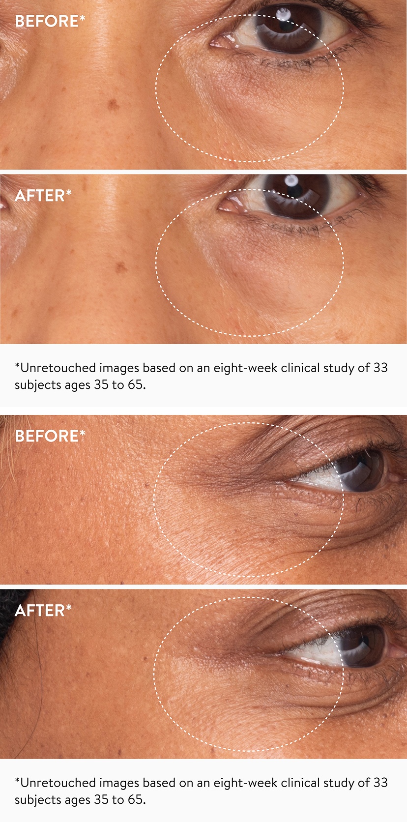 The Retinol Complex That Will Change Your Skin—and Revitalize Your Eyes ...