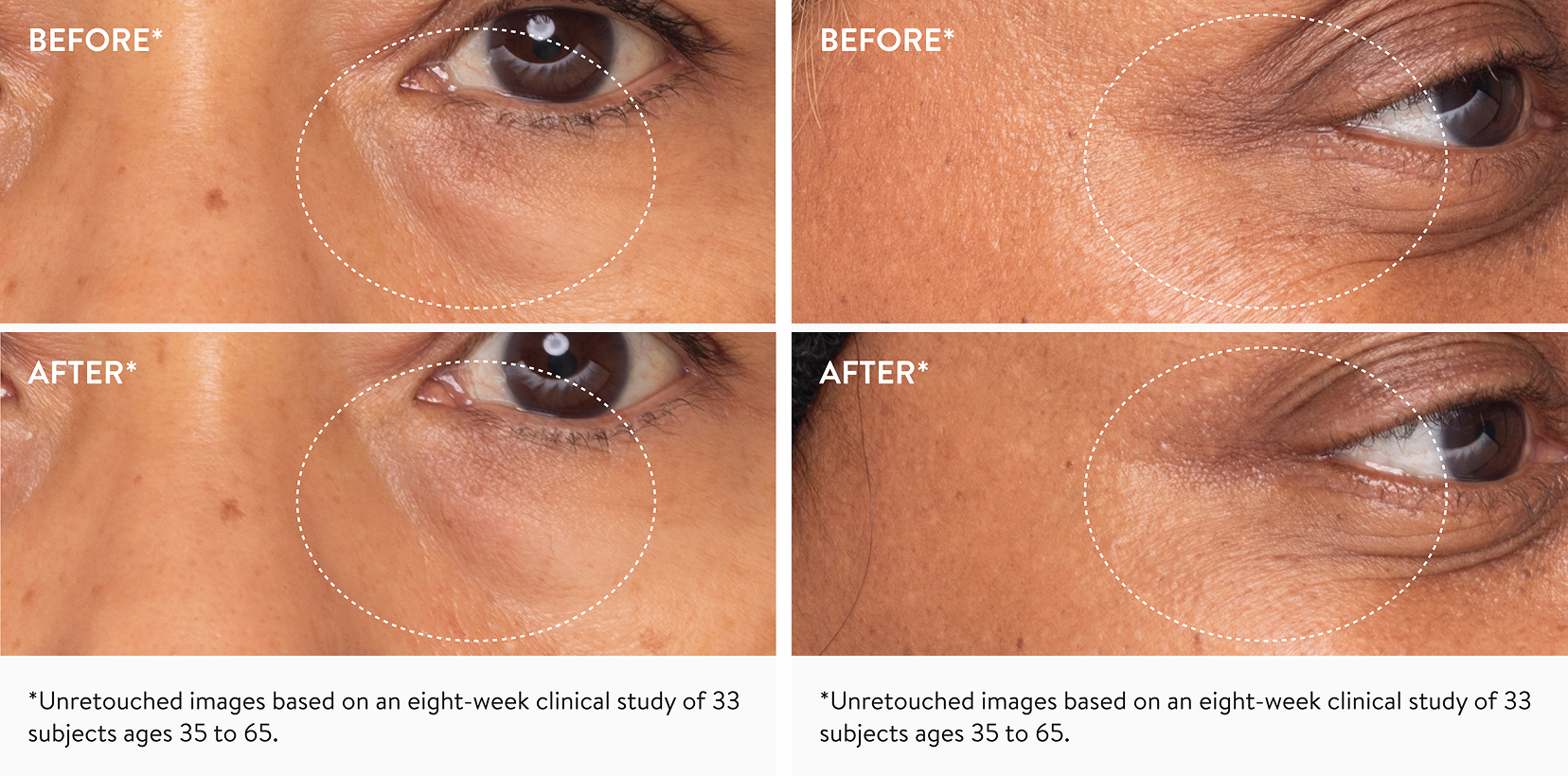 The Retinol Complex That Will Change Your Skin—and Revitalize Your Eyes ...